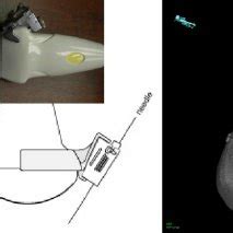 Matrix Probes Using A D Array Of Elements A The Beam Can Be Steered