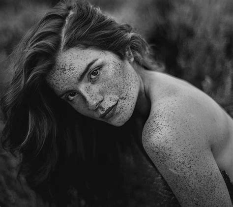 98 Freckled People Wholl Hypnotize You With Their Unique Beauty