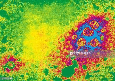 Dane Particle Photos And Premium High Res Pictures Getty Images