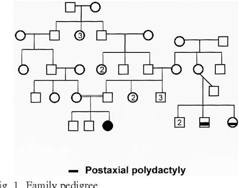 Figure 1 From Chondroectodermal Dysplasia Ellis Van Creveld Syndrome A Case Report