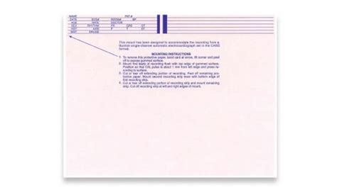 Quality Ecg Chart Papers At Reasonable Prices Guaranteed To Work