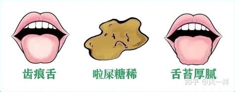 湿气重只需喝它，排出体内多年湿气，神奇！ 知乎