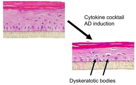 3d Atopic Dermatitis Model Non Artificial Human In Vitro Skin Tests Alcyomics