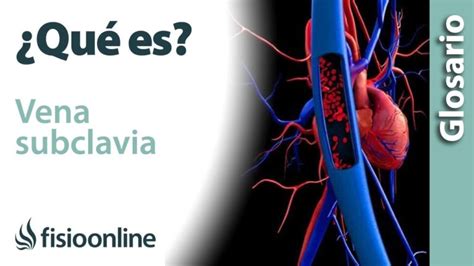֍ Vena Subclavia ⚕️ Clínica Estemedic