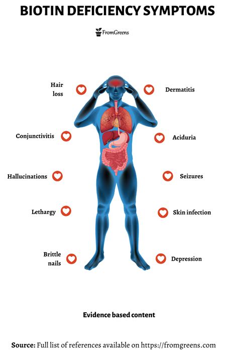 How To Tell Biotin Deficiency At Albert Jarman Blog