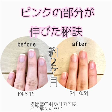 ネイルベッドオイル｜アンドネイルの口コミ 約2ヶ月でハイポニキウム を育成 By りゅーい敏感肌20代前半 Lips