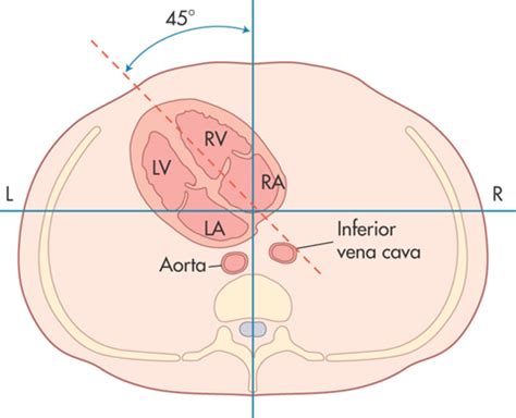Fetal Echo Intro Flashcards Quizlet