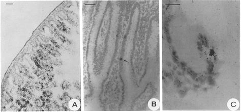 In Situ Hybridizations Of 3~s Labeled Afp Exon 1 Probe To Sections Of