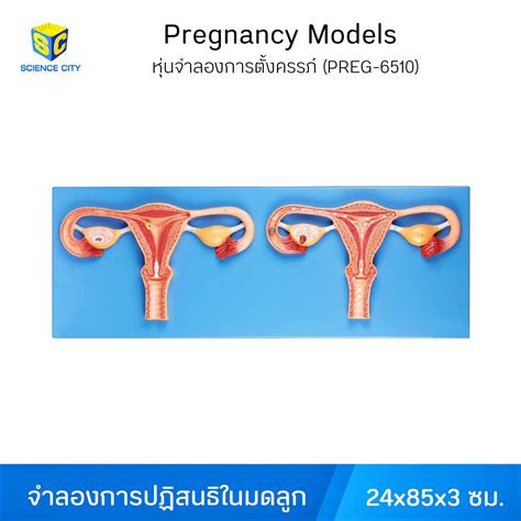 แบบจำลองแสดงการปฏิสนธิในมดลูก