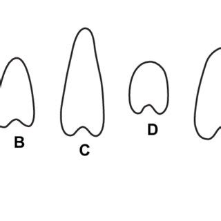 Cross Sections Of The Shells Of Species Of Pseudosubplanites And