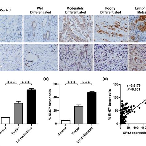 Qpcr And Western Blotting Analyses Showed That Gpx2 Expression Levels