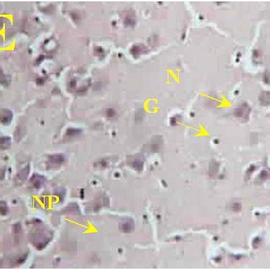Photomicrographs Of The Frontal Cortex Of Mice Which Mothers Were Fed Download Scientific