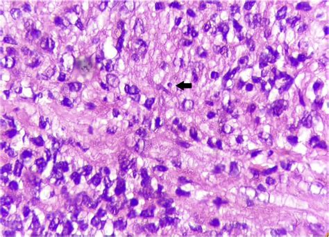 Histopathological Examination Hematoxylin And Eosin ×1000
