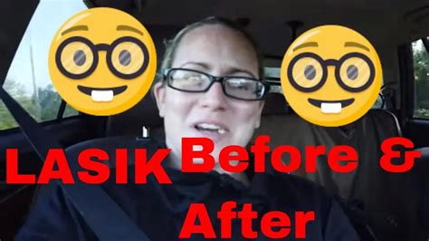 Lasik Eye Surgery 👁😎😮 Before During And One Week Later
