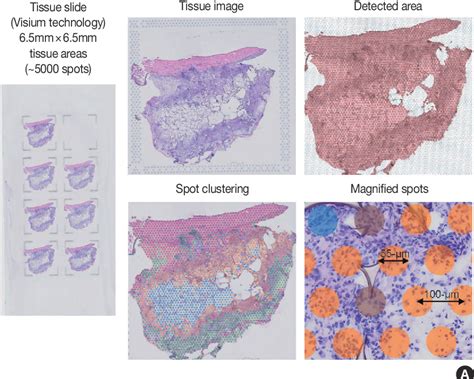 figure 2 from single cell and spatial sequencing application in