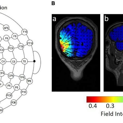 Electrode Montage And Simulated Distribution Of The Electrical Field Download Scientific