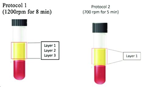 Prf Preparation Protocol 1 And Protocol 2 Download Scientific Diagram