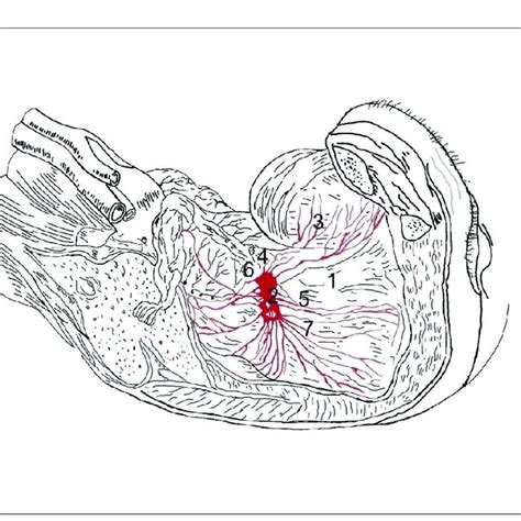 Division Of Cases According To Lateral Asymmetry Of The Pelvic Plexus Download Scientific Diagram
