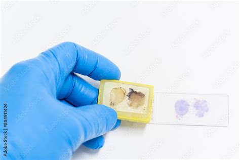 Scientist Wear Blue Glove Holding Paraffin Human Tissue Block And Out