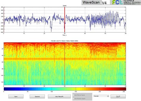 Wavescan Aspi