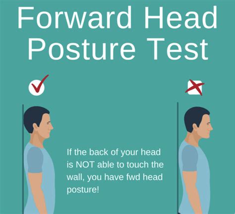 Types Of Postural Defects Bad Posture Names