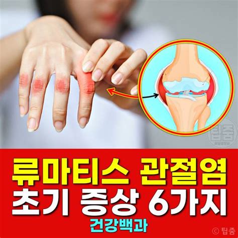 류마티스 관절염 초기 증상 6가지 류마티스관절염 자가진단