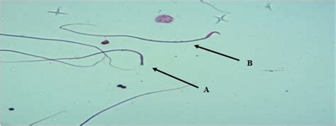 The Cdcl2 Treatment Group Shows A Defective Head Sperm And B Normal Download Scientific Diagram