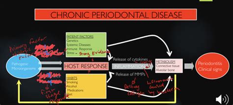 Etiopathogenesis Of Periodontitis Flashcards Quizlet
