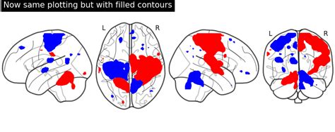 Glass Brain Plotting In Nilearn All Options Nilearn