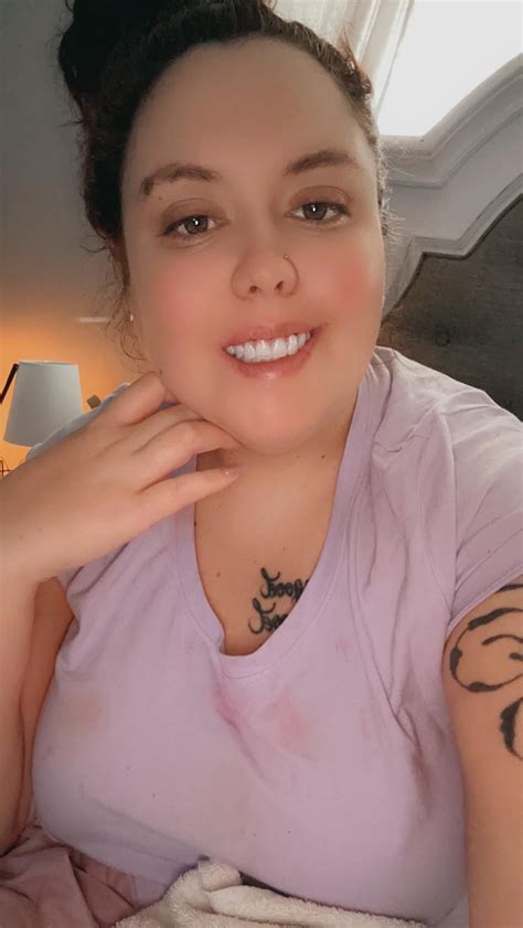 Open Face Dentures My Real Gumbone Protrudes Out To Far To Allow For