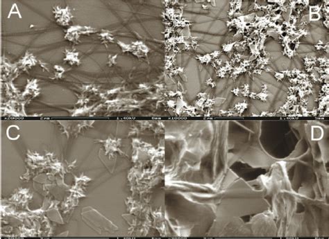 Scanning Electron Micrographs Of Mineralized Collagen Fi Brils In The