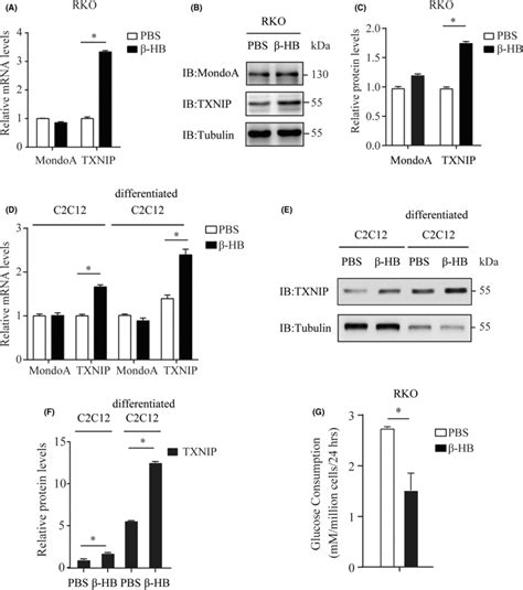ketone bodies promote txnip expression and reduce glucose uptake a