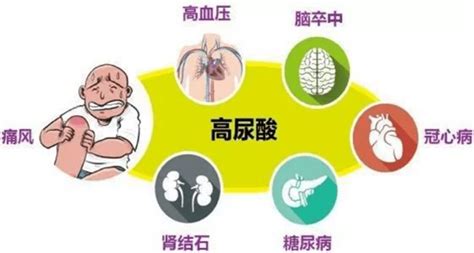 东坝健康微课堂 11 健康杀手—高尿酸血症 服务 相关 中心