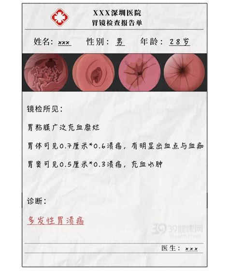 3种容易致癌的饮食习惯很多人天天这样吃 澎湃号湃客 澎湃新闻 The Paper