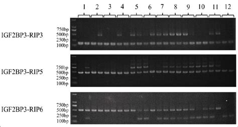 Polymorphism Detection Results Of The Three Rips By Pcr With 12 Dna