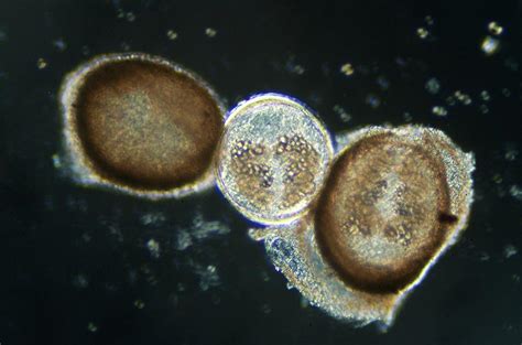 Fasciola Hepatica Metacercari Photograph By Sinclair Stammers Fine