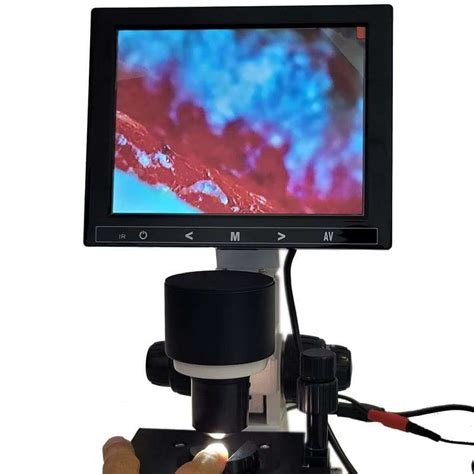 Nailfold Capillary Microscopy Microcirculation Detector Blood Sanatox