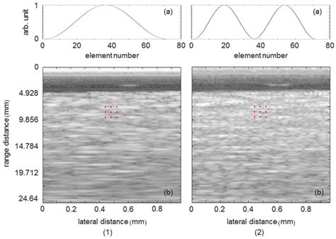 Phase Sensitive 2d Motion Estimators Using Frequency Spectra Of Ultrasonic Echoes