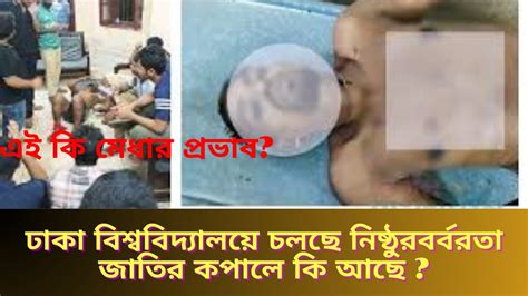 ঢাকা বিশ্ববিদ্যালয়ে চলছে নিষ্ঠুর বর্বরতা জাতির কপালে কি আছে এই কি