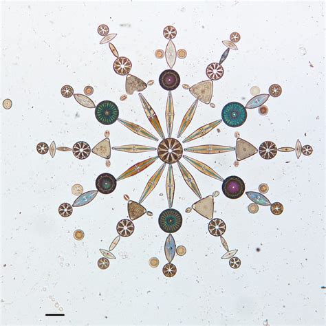Artistic Arrangements Of Microscopic Algae Viewed Through A Microscope