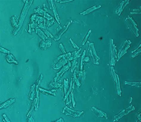 Morphology Of Normal Isolated Cardiomyocytes Under Microscope After