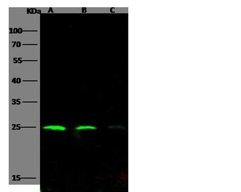 Hiv1 P24 Antibody Pa5 81773