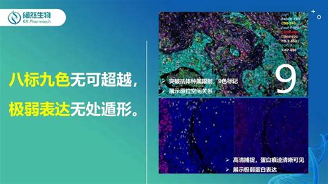 开拓下一代病理发展新时代！多重荧光免疫组化产品已在大三甲医院装机caclp体外诊断资讯网