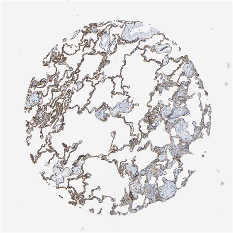 Tissue Expression Of Pdpn Staining In Lung The Human Protein Atlas