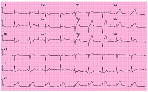 Acls Precourse Self Assessment Answers Driving Theory Course Prep