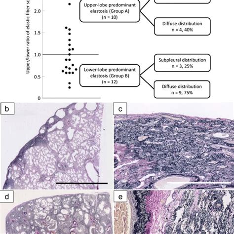 Aid Ild Patients With Elastosis Were Divided Into Two Groups Based On
