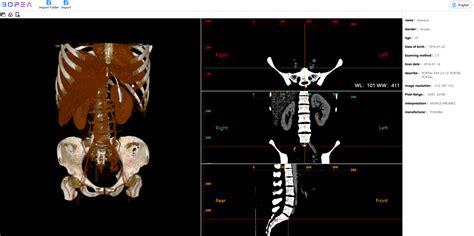 Free DICOM Viewer Online High Performance Medical Imaging Solution 3DPEA