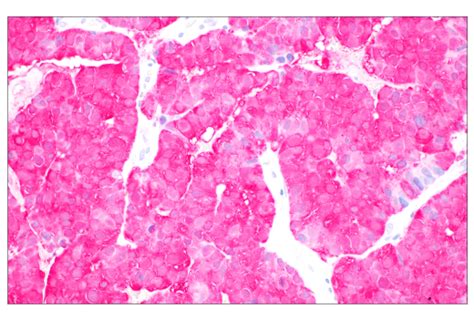 Signalstain® Boost Ihc Detection Reagent Ap Rat Cell Signaling