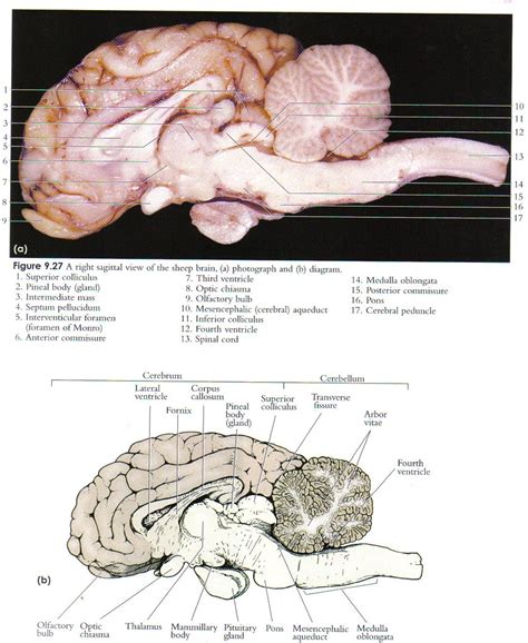 Sheep Brain Sagittal View