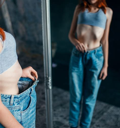 Anorexia Nervosa Victorybay Anorexia Nervosa Treatment